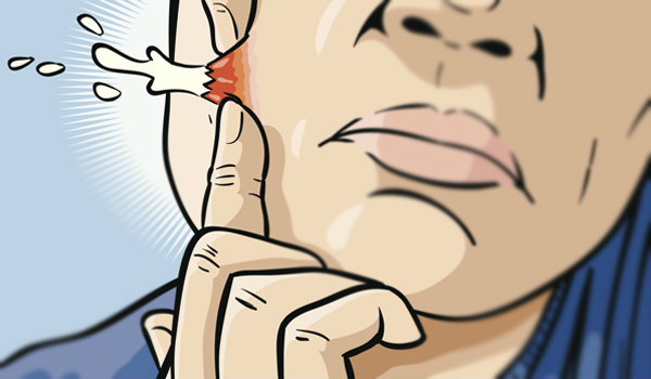 5 ความเชื่อผิดๆเกี่ยวกับ′สิว′ - Popcornfor2.com